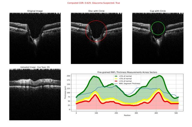 5g enabled world's first AI-enabled portable OCT