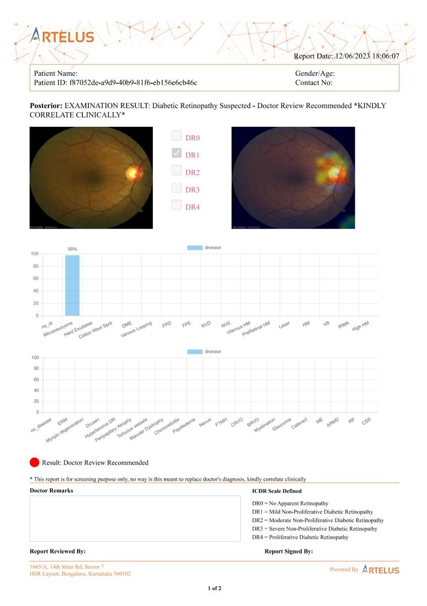DRISTi, Revolutionizing Retinal Screening in minutes