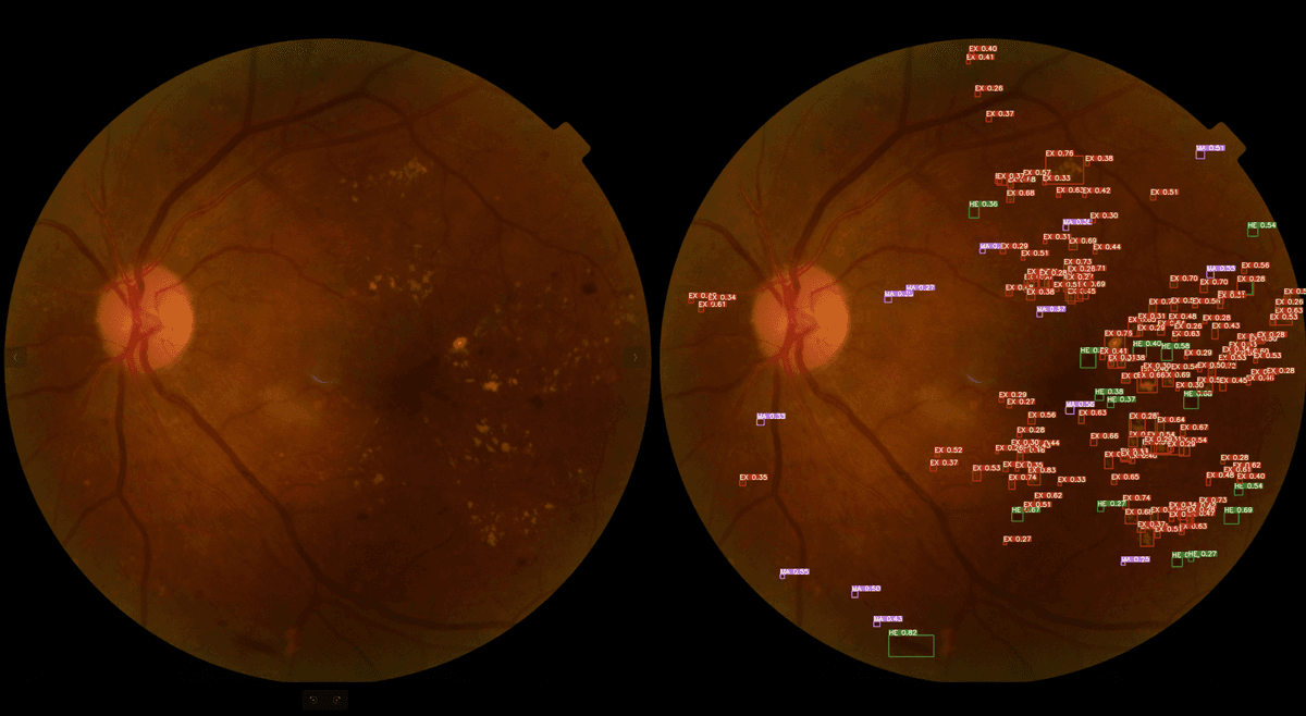Artelus - Empowering Healthcare with Artificial Intelligence