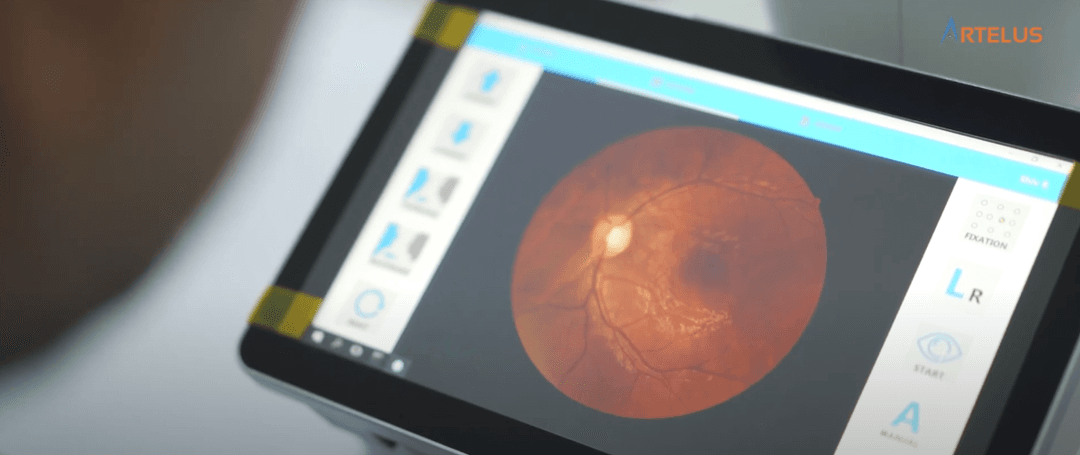 DRISTi, Revolutionizing Retinal Screening in minutes